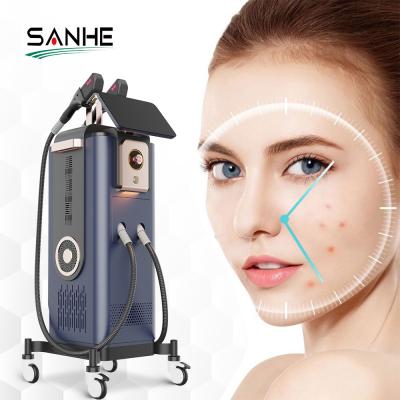 China DPL IPL OPT E-Light Permanent Hair Removal Skin Rejuvenation Machine 100nm 10Hz for sale