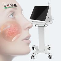 China 980nm Diode Laser Vascular Removal Machine 50W for Spider Vein Treatment for sale