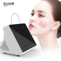China 980nm Diode Laser Vascular Removal Machine 50W for Spider Vein Treatment for sale