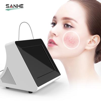 China 980nm Diode Laser Vascular Removal Machine 50W for Spider Vein Treatment for sale