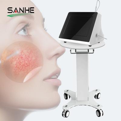 China Portable 980nm Diode Laser Vascular Therapy Machine 50W for Spider Vein Removal for sale