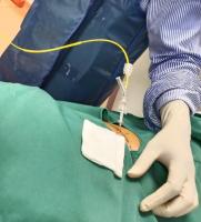 China 980nm PLDD Minimally Invasive Laser for sale