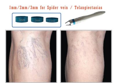 China 940nm Spider Vein Removal Machine 15 Watt Pain Free Laser Therapy for Home Use for sale