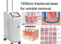 China 1550nm Er Glass Fractional Laser Machine 120mJ Skin Tightening Wrinkle Removal CE for sale