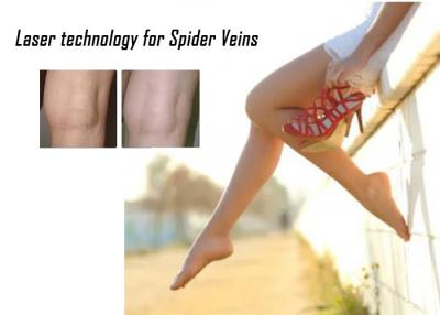 China 1064nm Spider Vein Removal Laser 532nm KTP Non Invasive Vein Treatment Machine 940nm for sale