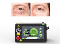 China 30W 980nm Medical Laser Equipment for Blepharoplasty Treatment for sale