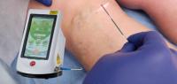 China Berylas Surgical Laser Equipment Pulse Mode No Stitches for sale