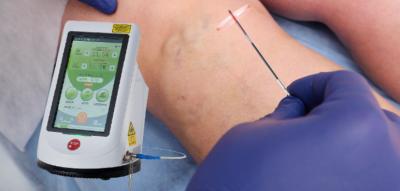 China Berylas Surgical Laser Equipment Pulse Mode No Stitches for sale