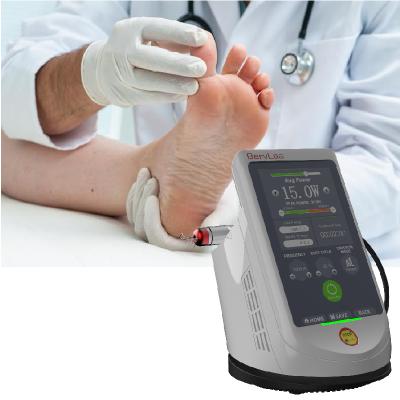 China Dual Wavelength Laser Podiatry Equipment for sale