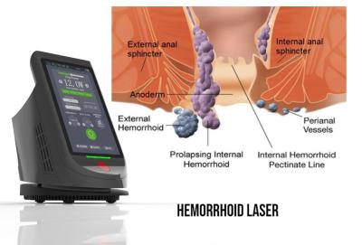 China 980nm 15W Diode Laser System with SMA905 Connector for Hemorrhoid Treatment for sale