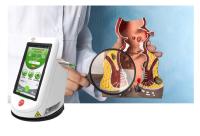 China 15W 980nm Diode Laser Machine for Hemorrhoid Treatment Surgical Piles Removal for sale