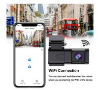 China 1.47 Inch IPS TFT LCD Display 172x320Resolution SPl interface GC9307 Driver lC350cd/m2 Customizable FPC TP 1500:1 Contrast Medical Devices for sale