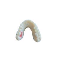 China Digital Oral Scanning PFM Dental Crowns Bridge Implantology Demands for sale