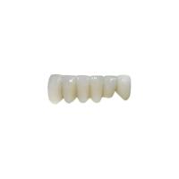 China Customized Zirconia Dental Crowns Excellent Aesthetics Durable Material for sale
