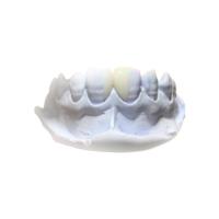 China Efficient Resin Removable PFM Dental Crown Health Materials for sale