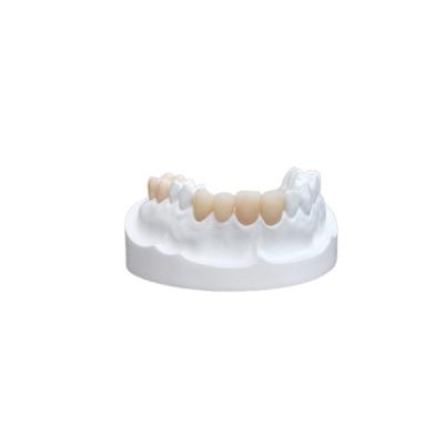 China Inlays Onlays Ceramic Dental Crown Strong Veneer For Dental Department for sale
