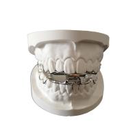 China OEM Dental Orthodontic Appliances High Strength 3D Digital Design for sale
