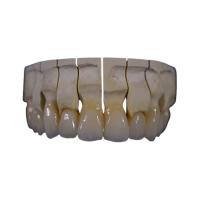 China Full Mouth Zirconia Dental Crown Restoration Zirconia Fixed Bridge Chemical Resistance for sale