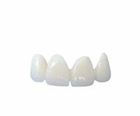 China Easy Cleaning All Ceramic Crowns Transparent Natural Shade Customizable for sale