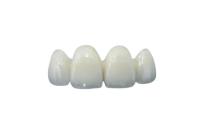 China Highly Biocompatible Zirconia Dental Crown Less Sensitive Abrasion Resistance for sale