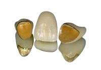 China Smooth Surface PFM Metal Porcelain Teeth Realistic Color Digitization Design for sale