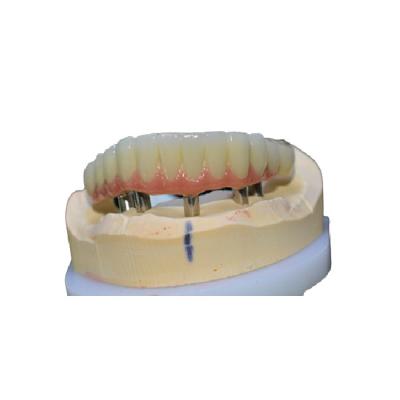 China Easy Cleaning Dental Implant Crown Comfortable No Foreign Body Sensation for sale