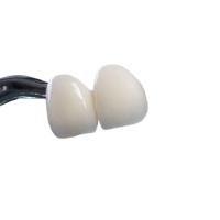 China Good Biocompatibility Zirconia Dental Crown Non Irritating Easy Cleaning for sale