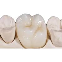 China White Porcelain Zirconia Dental Crown High Density Unobstructed for sale