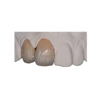 China Body Strength Thin Zirconia Crown Durable Natural Realistic Restoration for sale