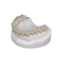 China Durable Zirconium Dioxide Crown No Odor No Corrosion No Irritation To Pulp Nerves for sale
