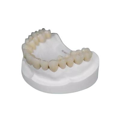China Durable Zirconium Dioxide Crown No Odor No Corrosion No Irritation To Pulp Nerves for sale