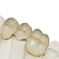 China Non Irritating Temporary Resin Crown With Good Biocompatibility for sale