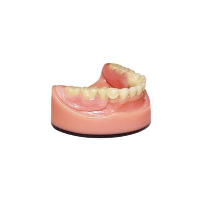 China OEM PFM Dental Bridge 3D Digital Intraoral Scanning Imaging System for sale