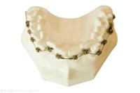 China Dental Brackets Orthodontics Fixed Tooth Modeling Tools Dental Braces for sale