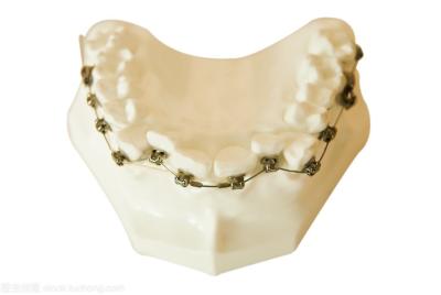 China Dental Brackets Orthodontics Fixed Tooth Modeling Tools Dental Braces for sale
