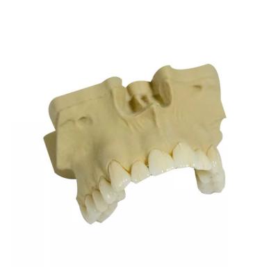 China Smooth Surface PFM Dental Crown High Strength Realistic Appearance for sale