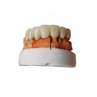 China Temporary PFM Dental Crown Smooth Surface High Quality Assurance for sale