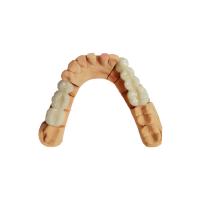 China Color Stable PFM Dental Crown Acid And Alkali Resistance Not Easy To Wear for sale