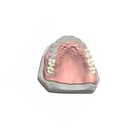 China Realistic Appearance PFM Dental Crown Quality Assurance 3D Printed Dental Models for sale