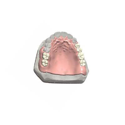 China Realistic Appearance PFM Dental Crown Quality Assurance 3D Printed Dental Models for sale