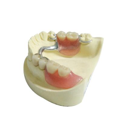 China CE Dental Lab Products Replacements Plastic Removable Partial Dentures for sale
