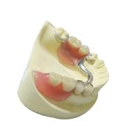 China Steel Removable Partial Dentures Denture Restoration Dental Lab Products for sale