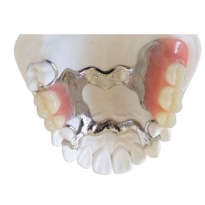 China OEM 3D Printer PFM Dental Crown Bridge High Biological Intermiscibility for sale