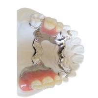 China 3D Printing PFM Dental Crown Customized High Biological Intermiscibility for sale
