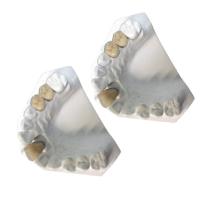 China High Strength Porcelain Dental Bridge Yellow Gold Color New Condition for sale