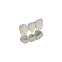 China Fit Properly Dental Crown Bridge Single Ended Fixed Bridge Crown for sale