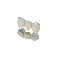 China Wear Natural Crown Bridge Teeth Titanium Alloy Single Ended Fixed Bridge Crown for sale