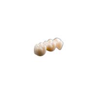 China Wear Natural Ceramic Dental Crown Rich Manufacturing Experience Comfortable for sale