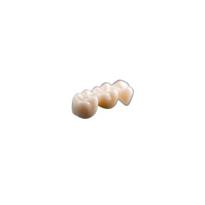 China Wear Natural Ceramic Dental Crown Rich Manufacturing Experience Comfortable for sale