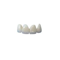 China Good Stability Ceramic Dental Crown Fit Properly Oral Hygiene High Quality for sale